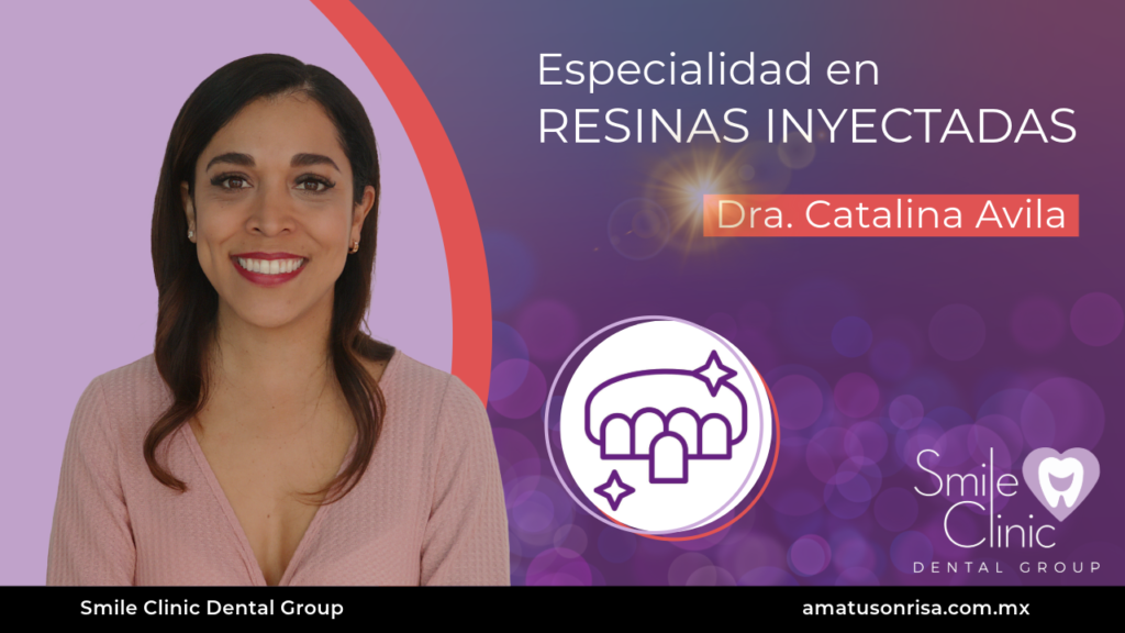 RESINAS INYECTADAS – SMILE CLINIC DENTAL GROUP